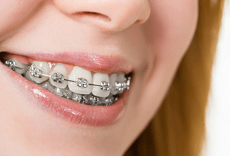 Orthodontics | Skin n' Smiles