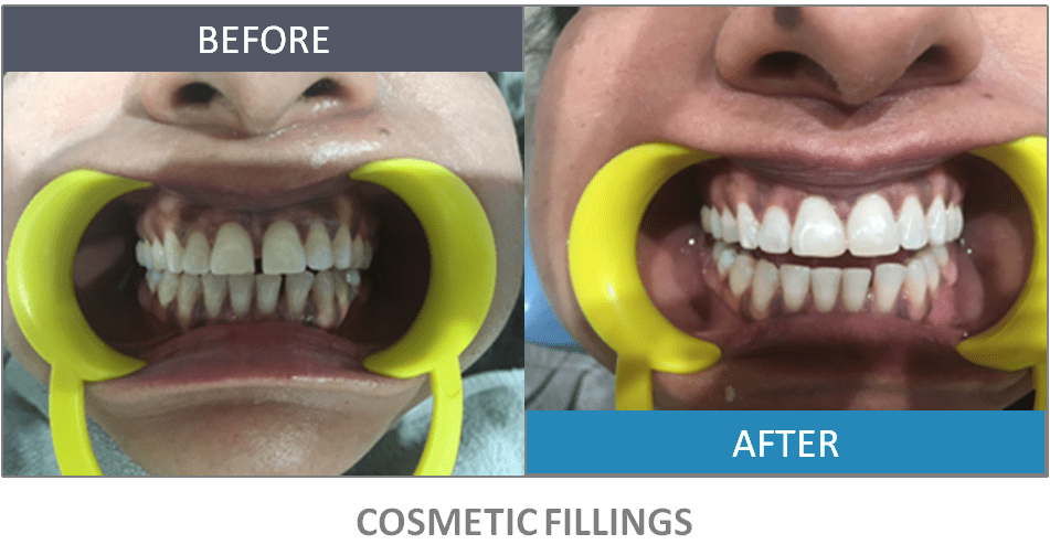 Smile Care | Skin n' Smiles